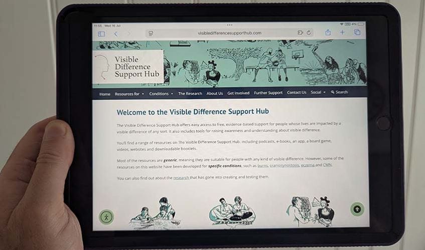 New Website Offers Groundbreaking Support for People with Visible ...