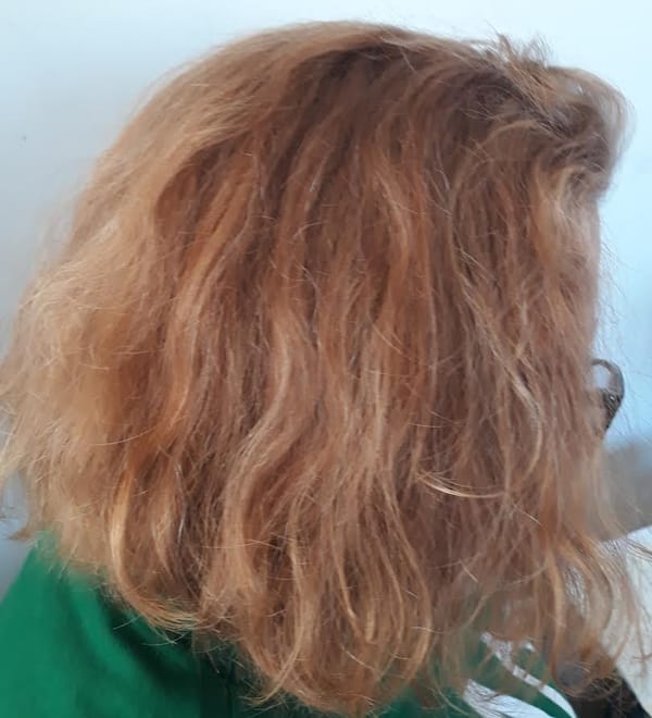 Why Do Some People Have Red Hair?